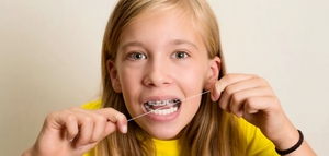 Brushing and Flossing with Braces | Santa Clarita, California | Kidz Dental Care SCV and PR